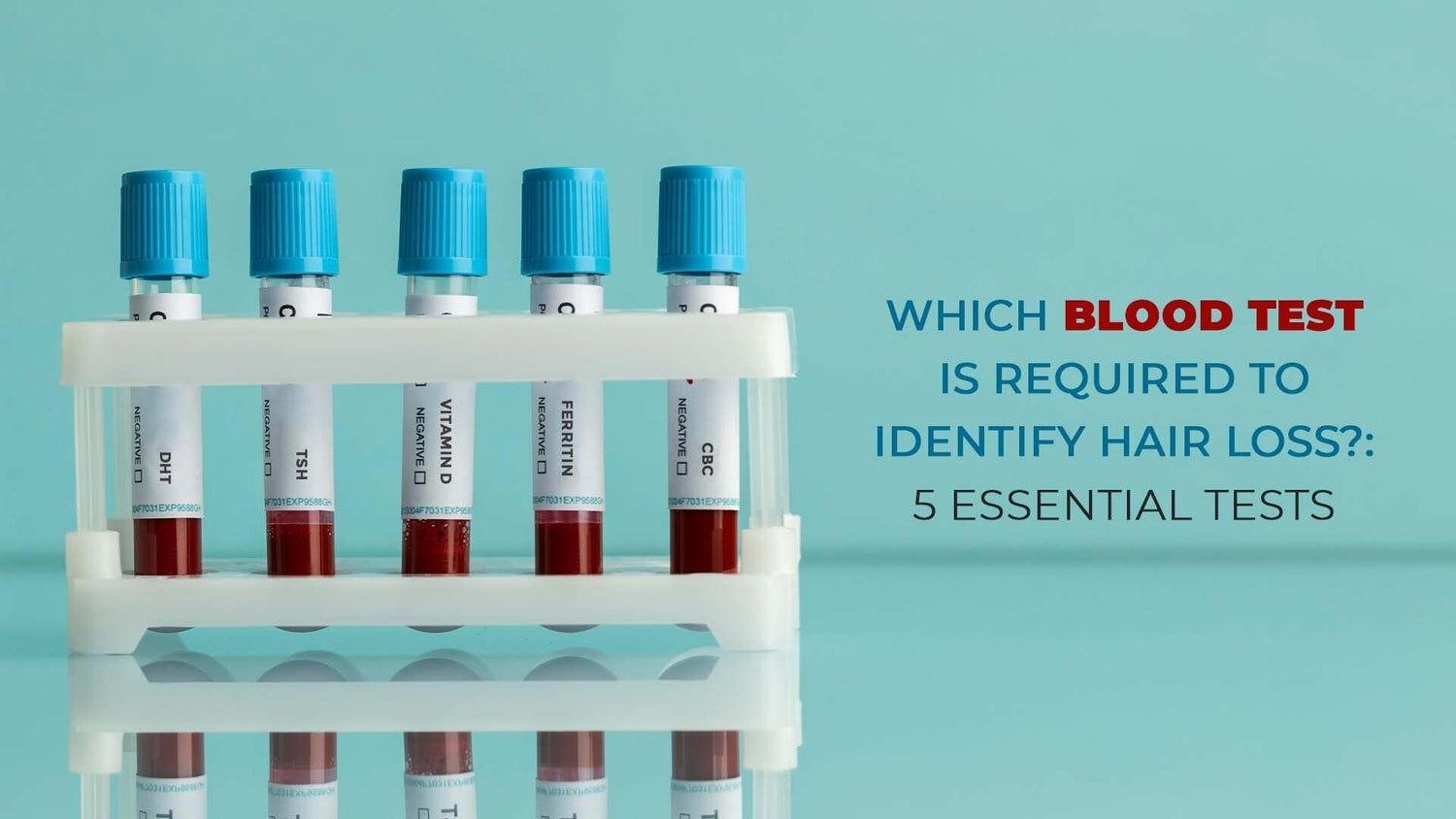 Which Blood Test is Required to Identify Hair Loss?: 5 Essential Tests ...
