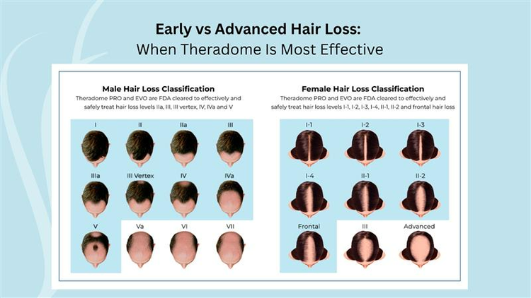 Early vs Advanced Hair Loss: When Theradome Is Most Effective